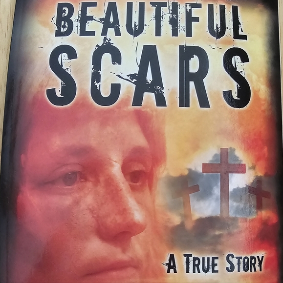 unbranded | Other | Beautiful Scars Book True Story Of How I Survived ...